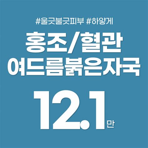 엑셀v홍조 혈관 여드름붉은자국 할인 가격 후기 전후 효과 정보 By 닥터제이미의원 여신티켓 국내 1등 피부과 성형외과 플랫폼