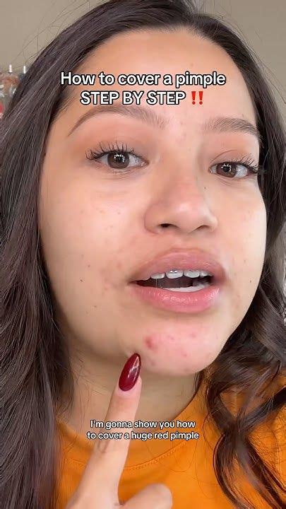 How To Cover A Huge Red Pimple STEP BY STEP Redness Pimple How To Cover Pimples How To