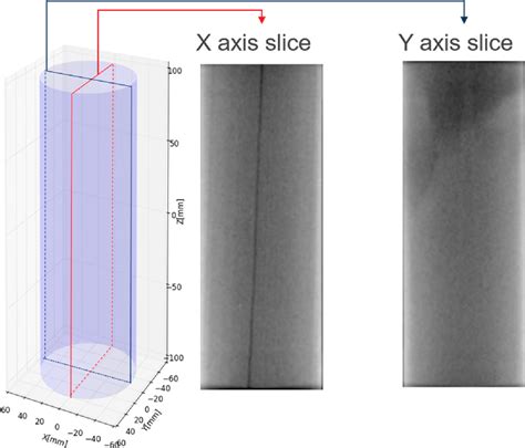 Figure 7 From Automatic Identification Of Fractures Using A Density