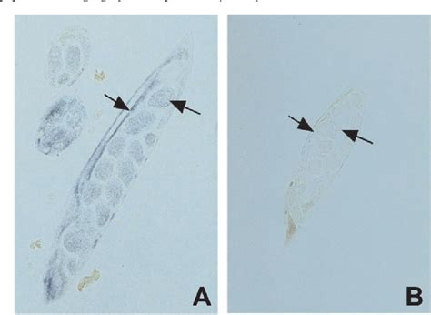 Figure 1 From A Complex Ii Defect Affects Mitochondrial Structure