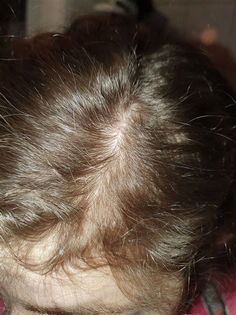 Красная точка на голове Советчица