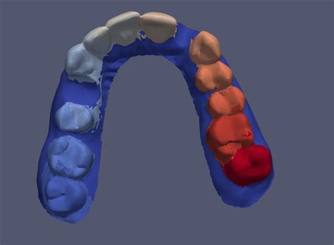 Teeth Landmark 02 Object Detection Model By UAEU2