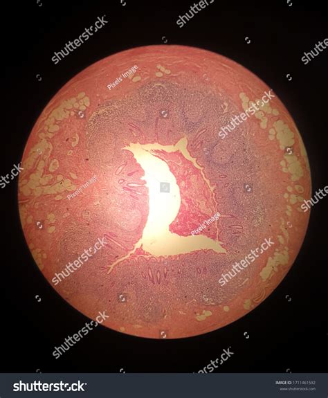 15 Size Of Appendix Images Stock Photos Vectors Shutterstock