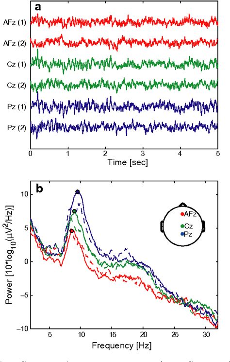 Figure 1 From Test Retest Reliability Of Resting Eeg Spectra Validates A Statistical Signature