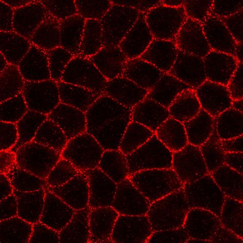 Questions With Answers In PLASMA MEMBRANE Science Topic