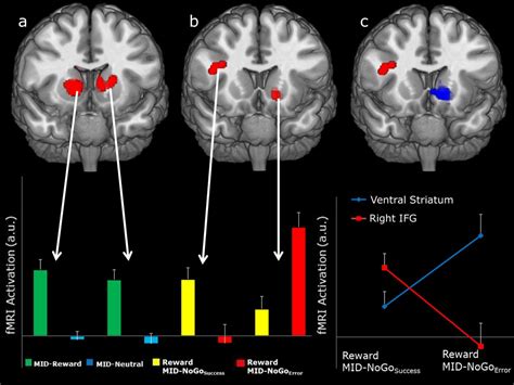 Ventral Striatum とは ハイパー直接路 Researchers Uncover Brain Circuit