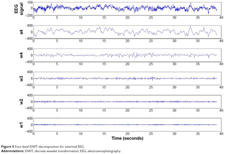 Automatic Epilepsy Detection Using Fractal Dimensions Segmentation And