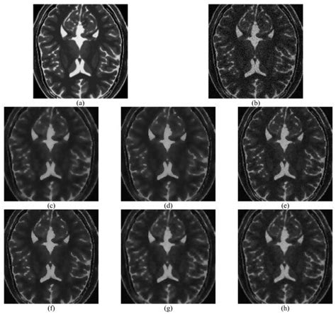 The Psnr And Ssim Measures For The Different Diffusion Algorithms At