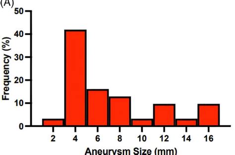 Unruptured Brain Aneurysms May Be Missed In Routine Clinical Care But
