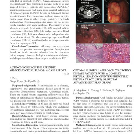 Proposed Algorithm For The Treatment Of Perianal Fi Stulas Due To Download Scientific Diagram