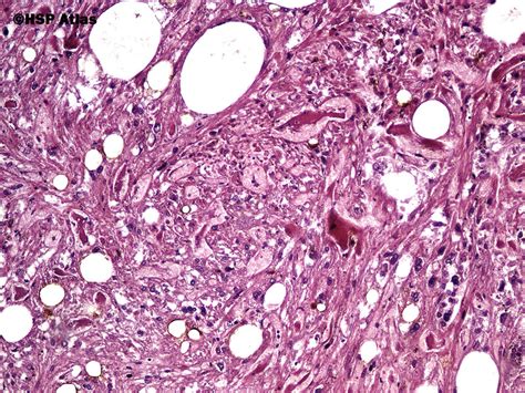Hsp Atlas Histopathology Atlas