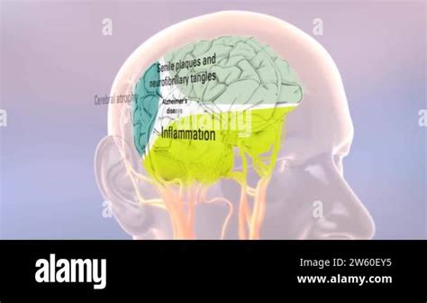 Amyloid Precursor Protein Stock Videos And Footage Hd And 4k Video Clips Alamy