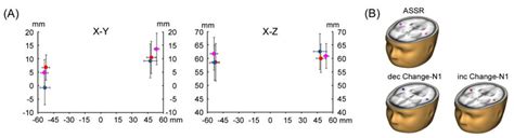 Dipole Location Mean Locations Of Estimated Current Dipole Ecd A Download Scientific