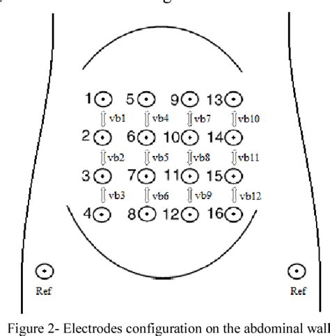 Figure 1 From Classification Of Uterine Emg Signals By Using Normalized Wavelet Packet Energy