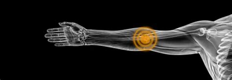 Elbow Ultrasound One Side London Private Ultrasound