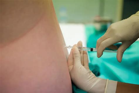 Epidural Nerve Block Injections Purpose Procedure Results