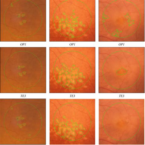 Non Uniform Illumination Correction Examples This Figure Shows One Download Scientific Diagram
