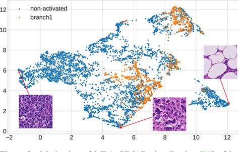 Attention Challenging Multiple Instance Learning For Whole Slide Image Classification