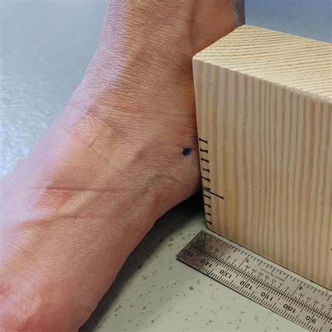 Assessing And Managing The Dysfunctional Midtarsal Joint
