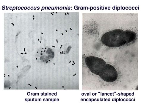 Streptococci And Pneumococci Ppt Download