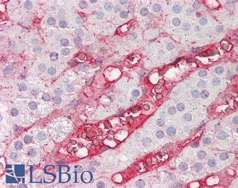 Ihc Plus™ Cfb Complement Factor B Polyclonal Antibody Goat Lsbio