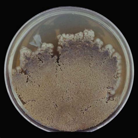 Example Chaetomium Globosum Adrian Carter Mycology