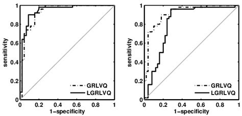 Roc Curves Of The Different Classifiers Based On 1408 Wavelet Download Scientific Diagram