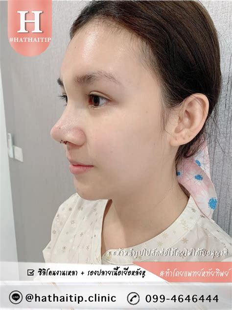 ละลายหมดแล้วใจ💕💕 ลูกสาวหมอวี สวยปังจริงๆ ~ ฟ รี ค่ า แ ก้ ~ ฟ รี ตั ด ไ ห ม ~ ป ร ะ กั น 1 ปี~ 🧣