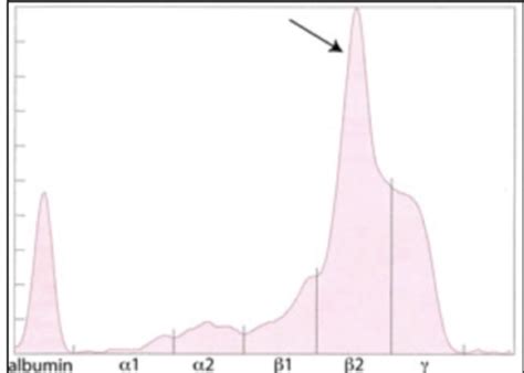 Proteins Flashcards Quizlet