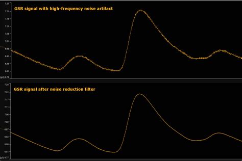Galvanic Skin Response Gsr
