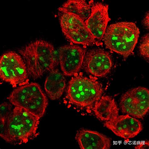 细胞免疫荧光全攻略：从样本制备到结果分析 知乎