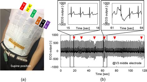 Experimental Results Of Multi Lead Ecg Measurements A Photograph Of Download Scientific