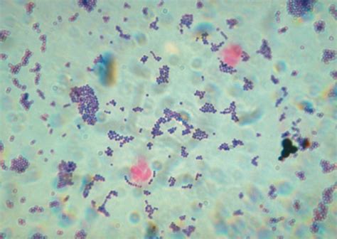 Staphylococcus Pt 1 Flashcards Quizlet