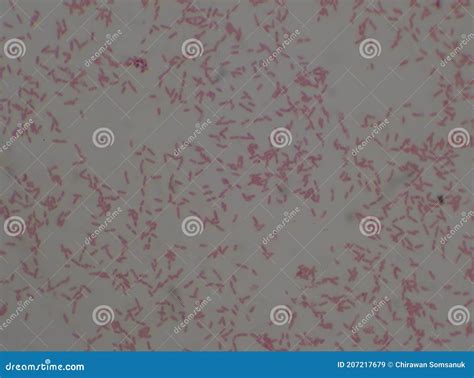 Gram Negative Bacilli With Bipolar Stain Bacteriaburkholderia