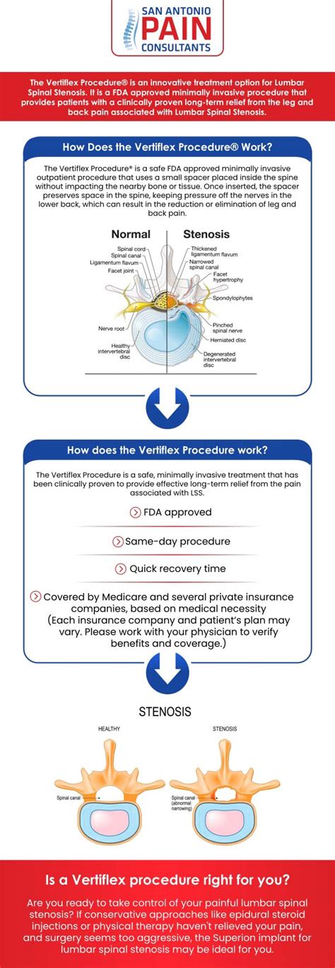 Vertiflex Procedure Specialist Near Me In San Antonio Tx
