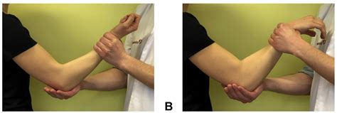 New Distal Biceps Provocation Test For Hand Therapist