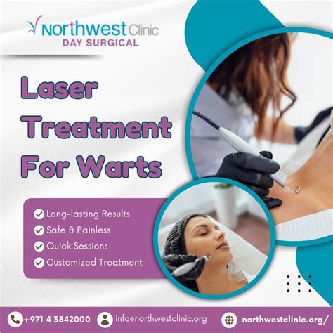 Laser Treatment For Warts Northwest Clinic Day Surgical