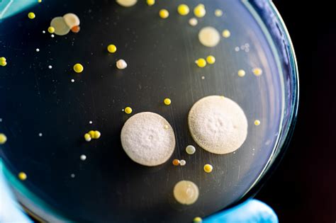 미생물학 실험실에서 교육을 위한 토양 샘플에서 천접시에서 자라는 특성과 다양한 모양의 박테리아 및 곰팡이 의 배경 0명에 대한 스톡 사진 및 기타 이미지 Istock
