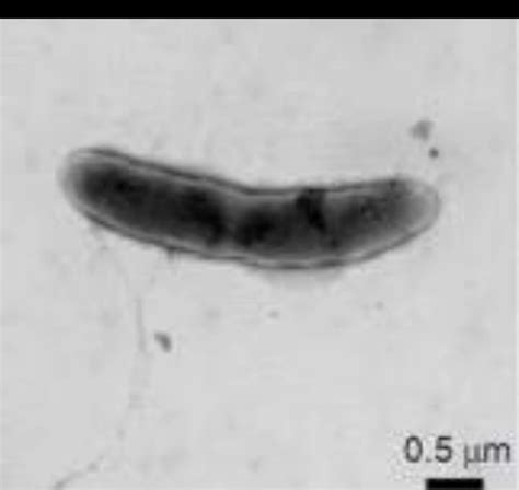 Heartdisease Bacteria Oscillibacter Guthealth Gutmicrobiome… Prachi Suman Biotechnologist