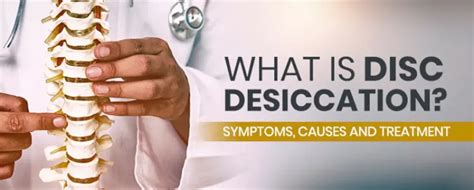What Is Disc Desiccation Symptoms Causes And Treatment