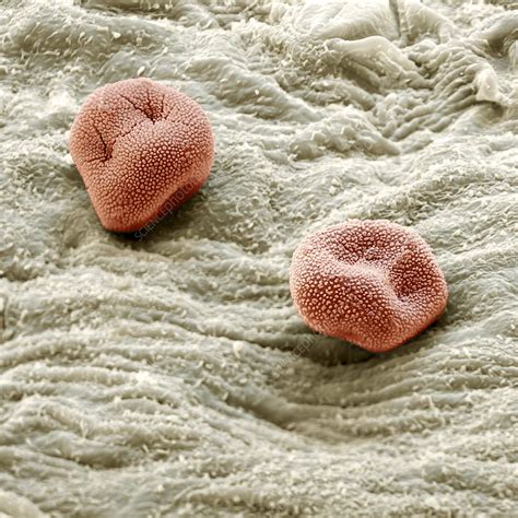 Rust Fungus Spores SEM Stock Image B Science Photo Library