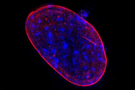 Measuring Chromosome Imbalance Could Clarify Cancer Prognosis Mit