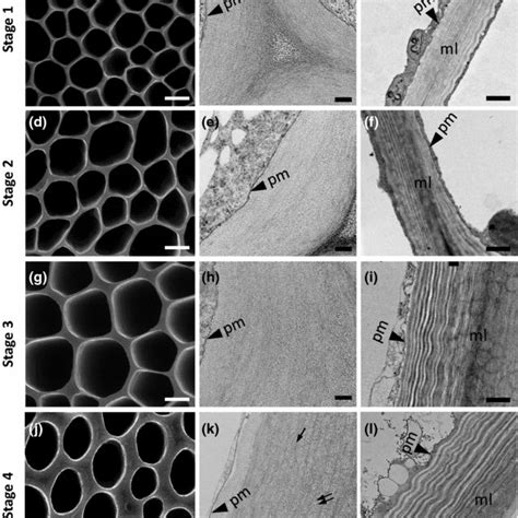 Electron Micrographs Of Collenchyma Cells And Cell Walls At Different Download Scientific