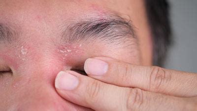 Home Remedies For Health Ailments Natural Cure And Remedies Naturopathy