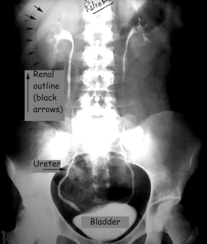 Med Imaging Gu Flashcards Quizlet