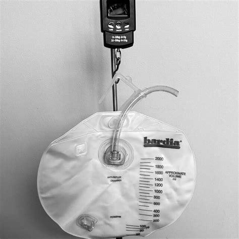 Photograph Of The Assembled Iot Urine Scale Download Scientific Diagram