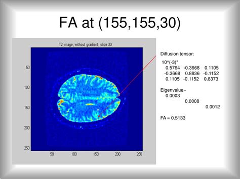 Ppt Visualizing Diffusion Tensor Imaging Data With Merging Ellipsoids Powerpoint Presentation