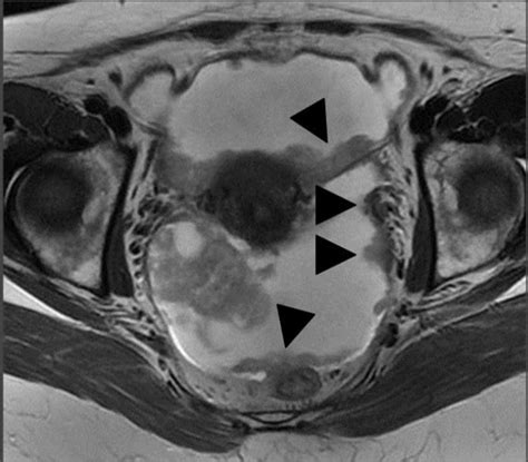 Orads Calculator And Report Generator Us And Mri