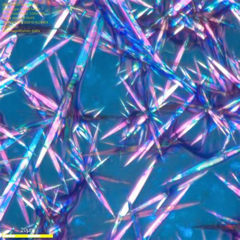 C Elegans X40 Magnification Rmicroscopy