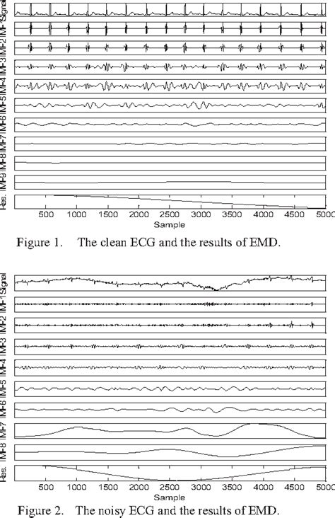 Figure 1 From A New Qrs Detector Based On Empirical Mode Decomposition Semantic Scholar